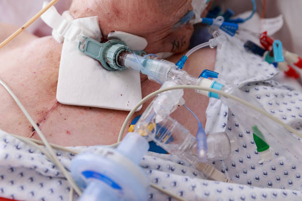 Zentralvenöse Katheter - ZVK: Viel mehr als Routine