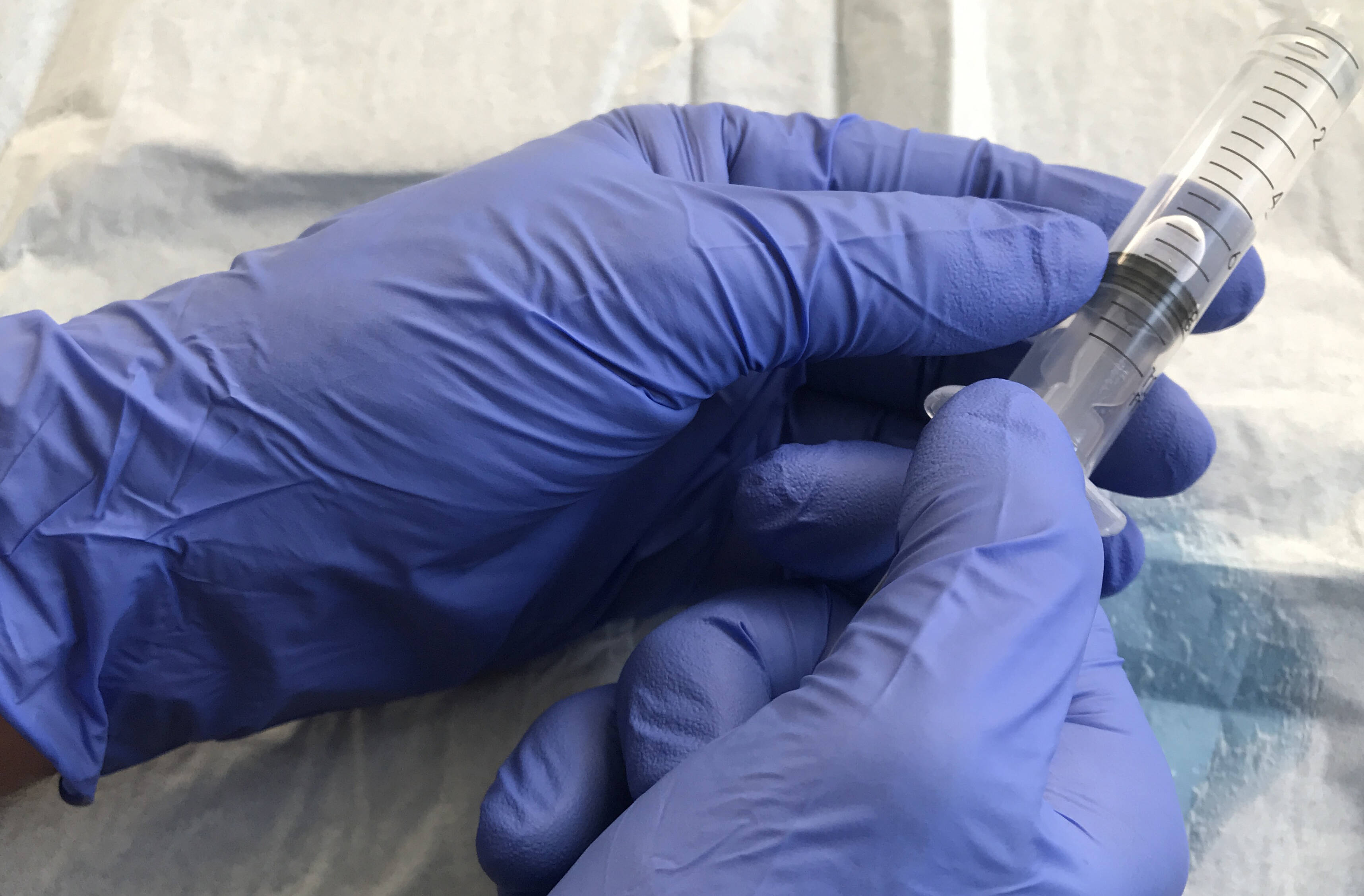 Eine seltene, aber lebensbedrohliche Komplikation